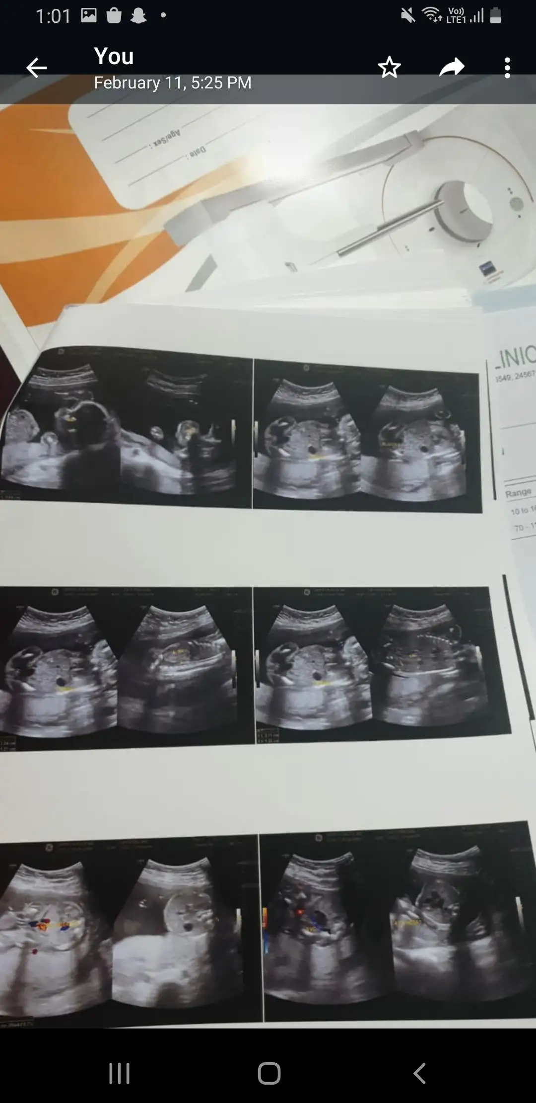 Level 2 Ultrasound Report Level 2 Ultrasound Report