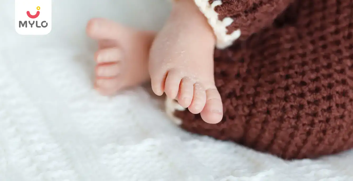 Newborn’s Skin Peeling: Causes & Treatment | MyloFamily